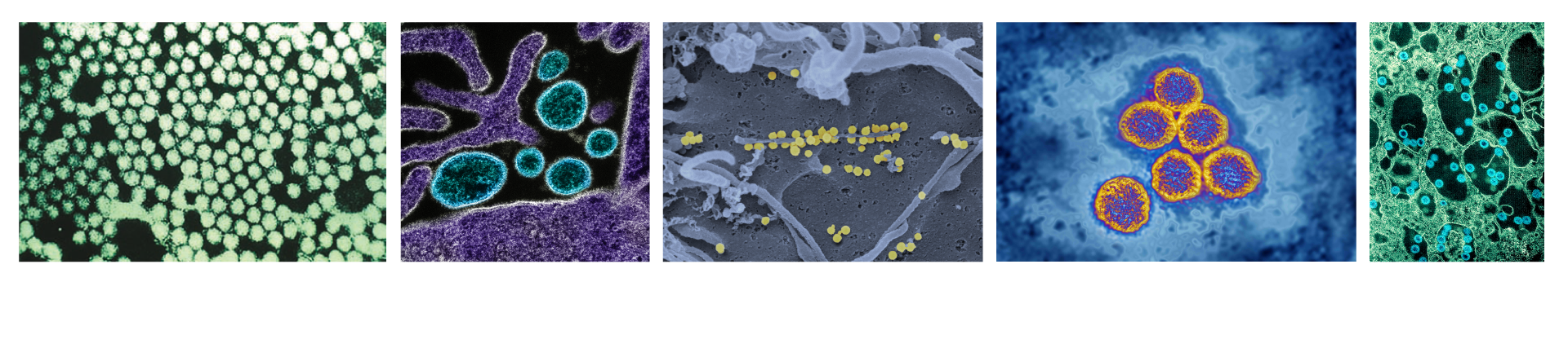 The future home of the world's most dangerous pathogens - Coda Story