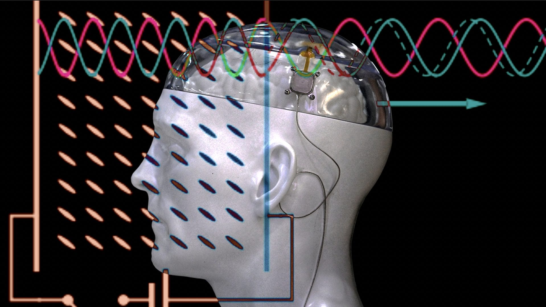 Who owns the rights to your brain? - Coda Story